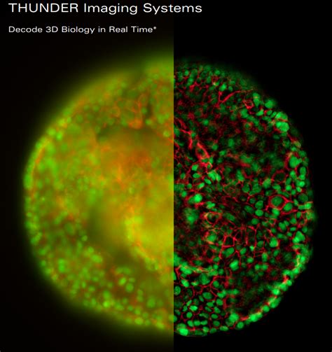 Leica Thunder Wide Field Fluorescence Microscope With Computational Clearing And Deconvolution