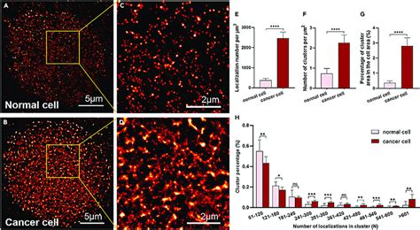 The Distribution Of Cdcp1 On Primary Non Small Lung Cancer Cells And Download Scientific