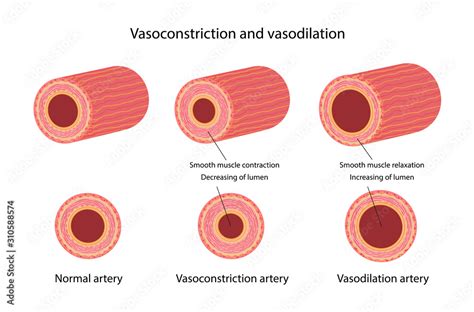 Poster Arterial Vasoconstriction And Vasodilation Wall Art Ukposters