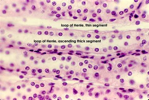 Loop Of Henle Histology Histology Slides 1