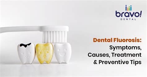 Dental Fluorosis Symptoms Causes Treatment And Preventive Tips Bravo