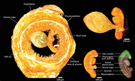 Micro Ct Of Early Human Development Radiology
