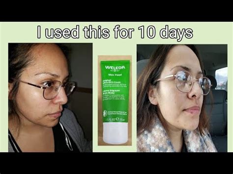 Weleda Skin Food Ultra Rich Cream Seborrheic Dermatitis Relief Youtube