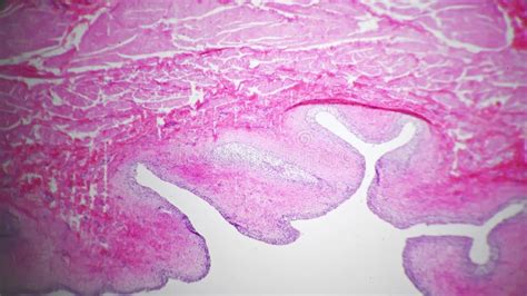 Transitional Epithelium Of Man In Section Filmed Under Microscope 40x