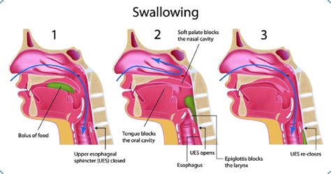 Vault With Your Voice Speech And Swallowing Services Topics In Adult