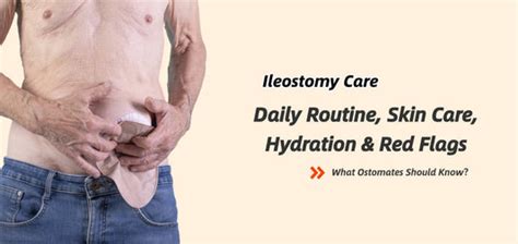 Understanding Stoma Output Color Consistency Frequency And Warning