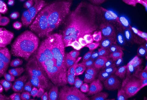 Watt Lab Research Image Mouse Oral Keratinocytes 2