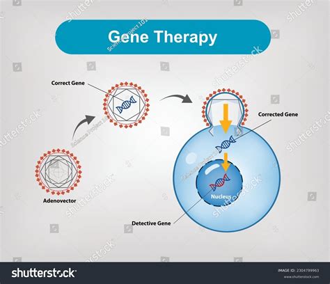 Gene Therapy Ka Diagram