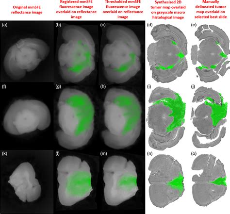 Calibration Of Fluorescence Imaging For Tumor Surgical Margin Delineation Multistep