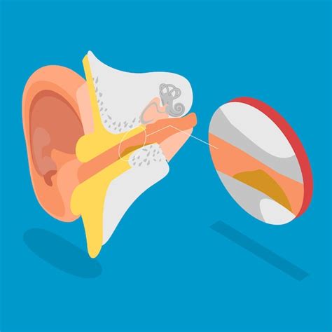 Ear Canal Trouble Vectors And Illustrations For Free Download Freepik