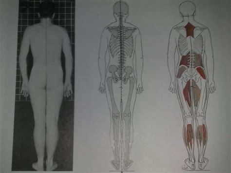 Postural Assessment Presentation2010pptx