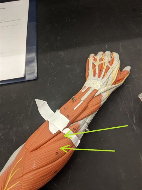 Is This Extensor Carpi Radialis Longus Brevis Ranatomy