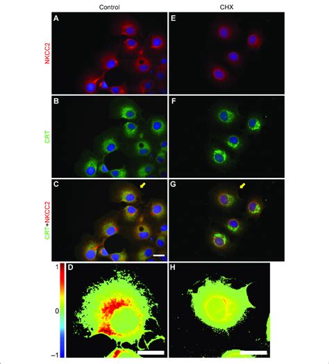 Nkcc2 Localizes To The Er Of Cos7 Cells A D Cos7 Cells