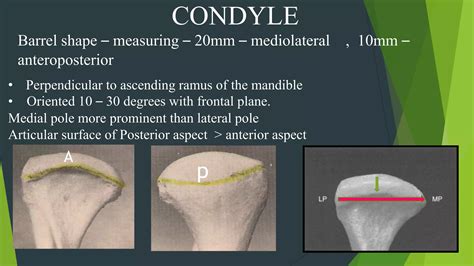 Presentation Temporomandibular Joint Anatomy Pptx