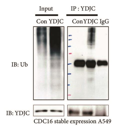 Ydjc Downregulates Pp2a Expression And Cdc16 Reverses It A Cdc16 Download Scientific