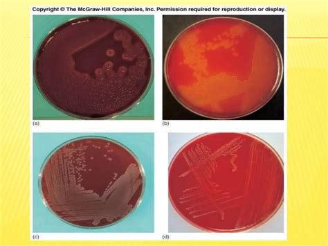 Streptococcus Pptx