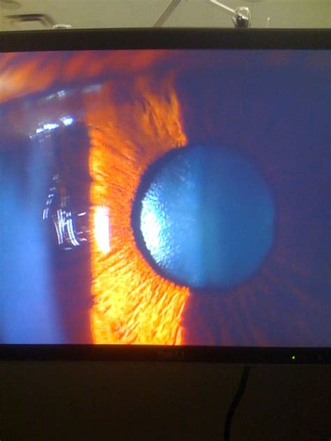 We Are Still Here Optometry Students