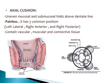 Anal And Perianal Diseases Ppt