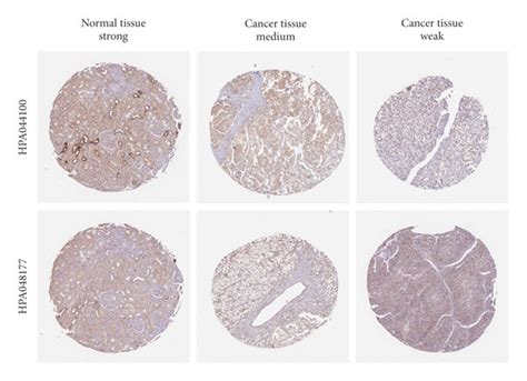 Assessment Of Fech Gene Expression In Geo Datasets And The Hpa Data
