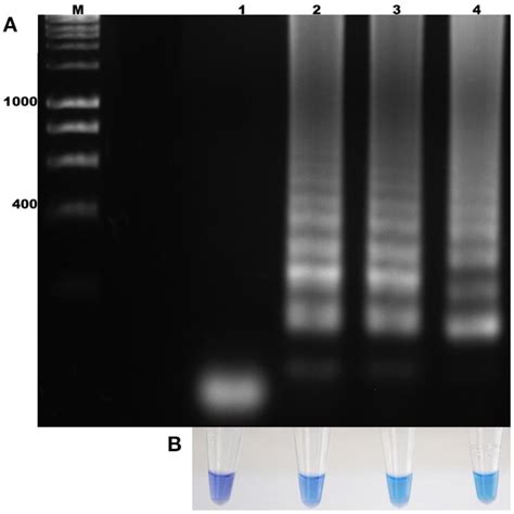 Figure E Diagnostic Specificity Analysis Of The Lamp Technique For The
