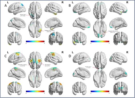 Sex Differences In Functional Gradients And Dynamic Functional
