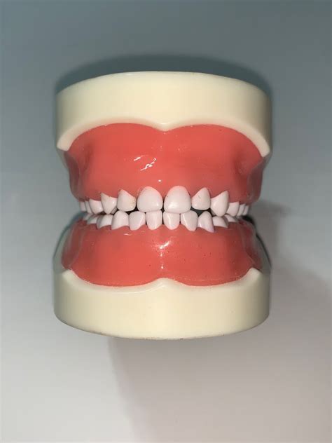 Trimunt Pedodontic Jaw Model On Carousell