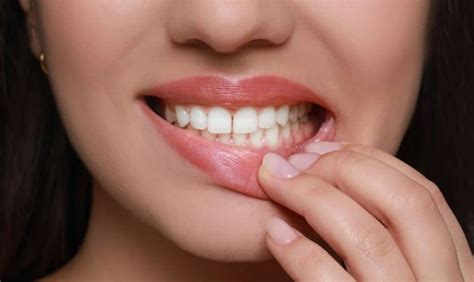 Oils That Can Help To Reduce Gum Inflammation