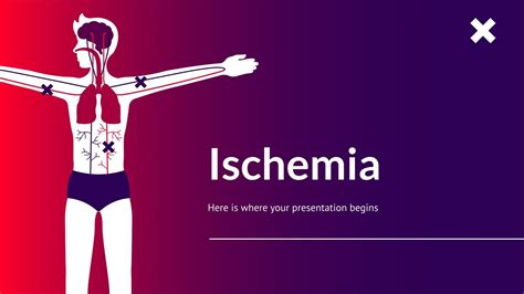 Ischemia Presentation