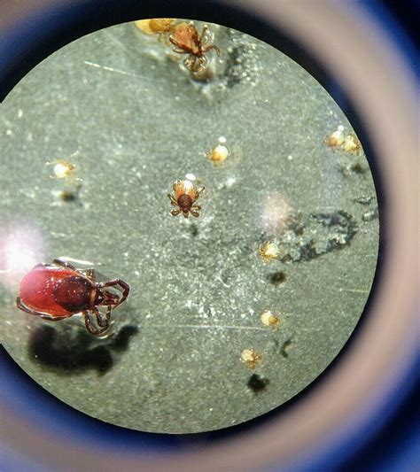 Ticks Through A Microscope Photo Laura Beloff Download Scientific