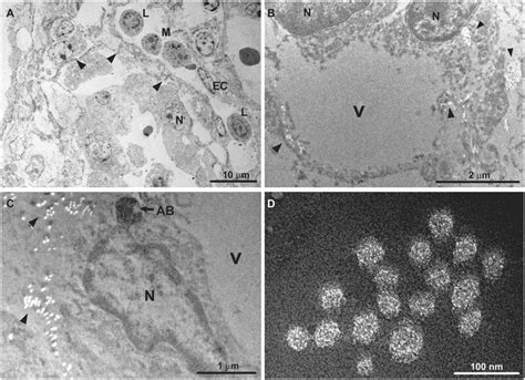 Transmission Electron Micrograph Of The Choroid Plexus Of Newborn