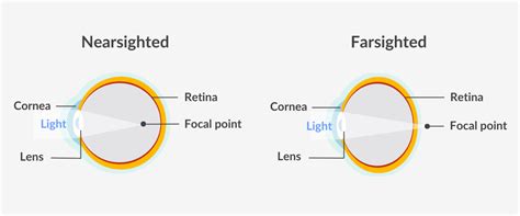 Eye Anatomy Vision Direct Au