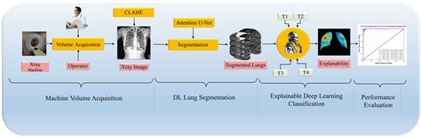 Four Transformer Based Deep Learning Classifiers Embedded With An Attention U Net Based Lung