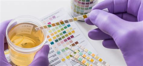 Are You Healthy Find Out With This Urine Color Chart Aeroflow Urology