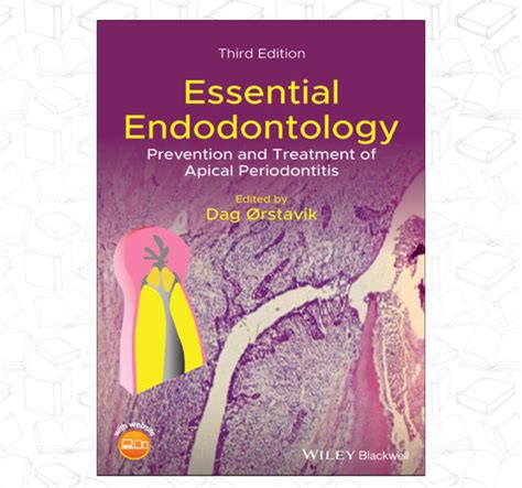 Essential Endodontology Prevention And Treatment Of Apical Periodontitis Third Edition