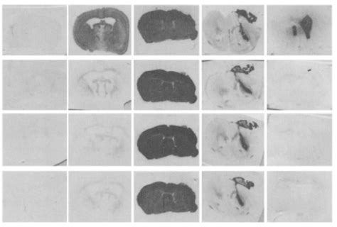 Accumulation Of Prp Sc In Brain Grafts Histoblots Showing Download Scientific Diagram