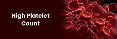 Understanding High Platelet Count Vital Health Insights
