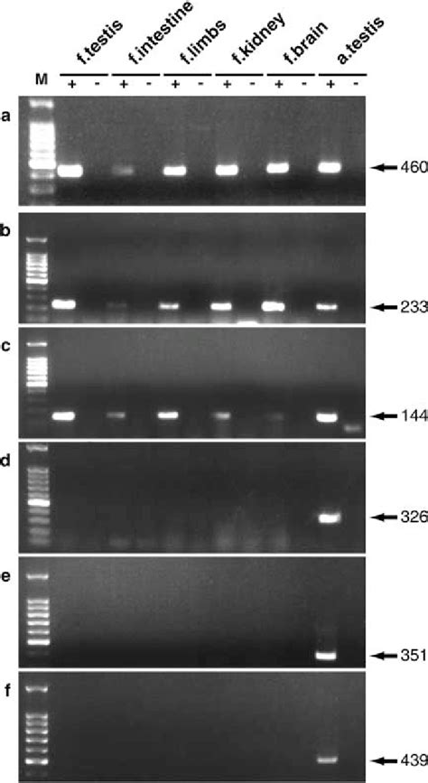 Analysis Of Prnp Prnd And Prnt Expression In Human Fetal Tissues