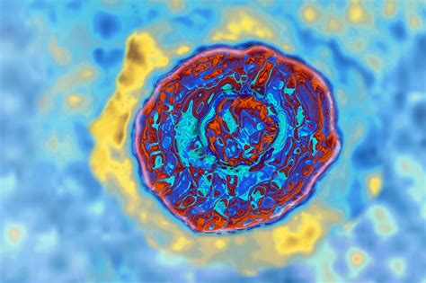 Hep C Has A Secret Strategy To Evade The Immune