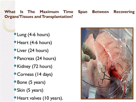 Organ Transplantation Ppt