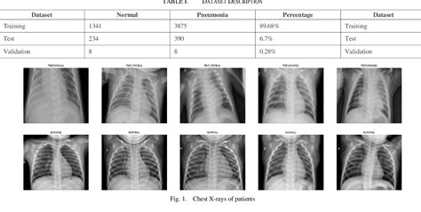 Figure 1 From Automated Pneumonia Diagnosis Using A 2d Deep Convolutional Neural Network With