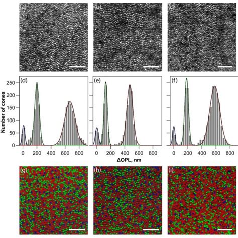 Cone Spectral Classification With Densitometry And Org Fig 9a And B Download Scientific Diagram