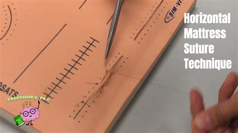 Horizontal Mattress Suture Technique Youtube