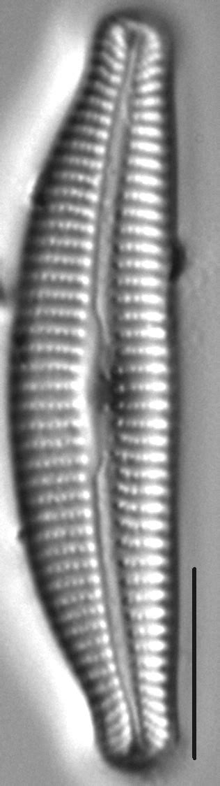 Image Cymbella Rumrichae3  Species Diatoms Of North America