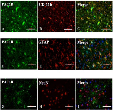 Double Immunostaining Of Pac1r With Cell Markers In The Perifocal Area
