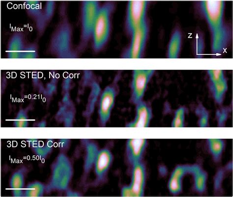 Adaptive Super Resolution Microscopy For Imaging Thick Samples