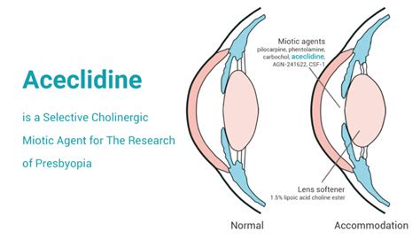 Aceclidine Is A Selective Cholinergic Miotic Agent For The Research Of