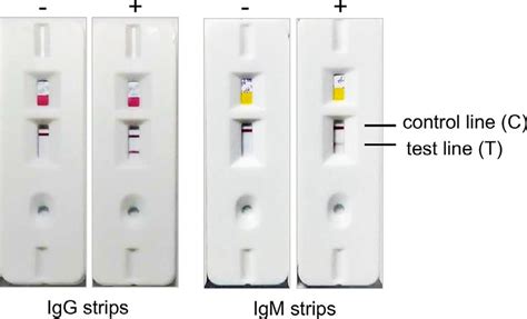 Typical Results Of The Icg Test Strip For Igg A And Igm B