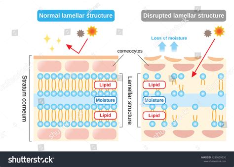 Stratum Corneum