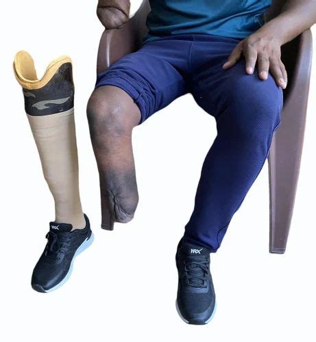 Artificial Leg Limb At ₹ 35000 Piece Artificial Limbs In Siliguri Id 2853490694033