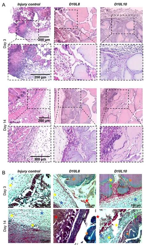 Injectable Nanoengineered Adhesive Hydrogel For Treating Enterocutaneous Fistulas Pmc